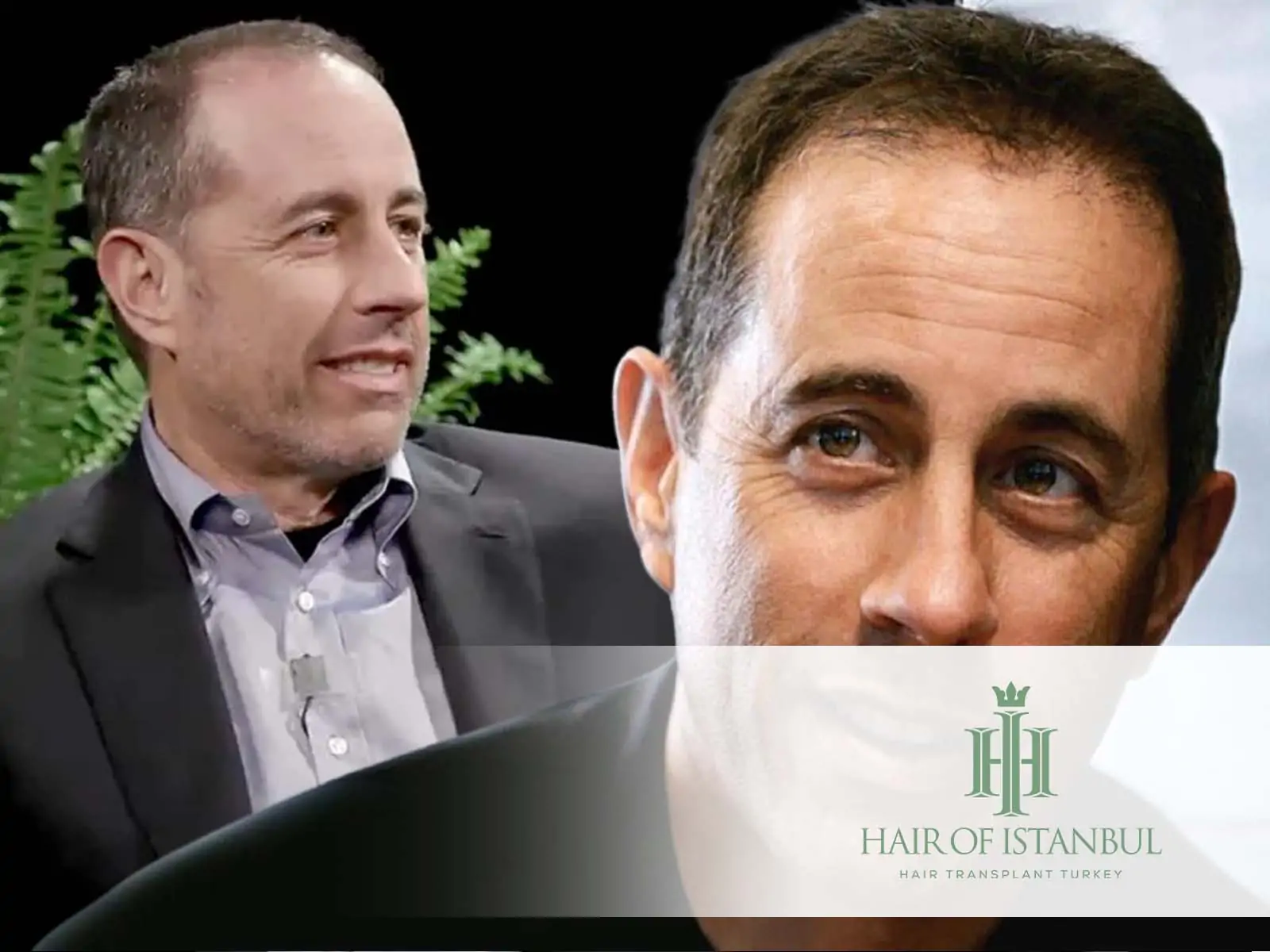 Jerry Seinfeld Hair Transplant: Truth Behind Speculations
