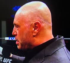 Joe Rogan Hair Transplant: Detailed Analysis and Facts